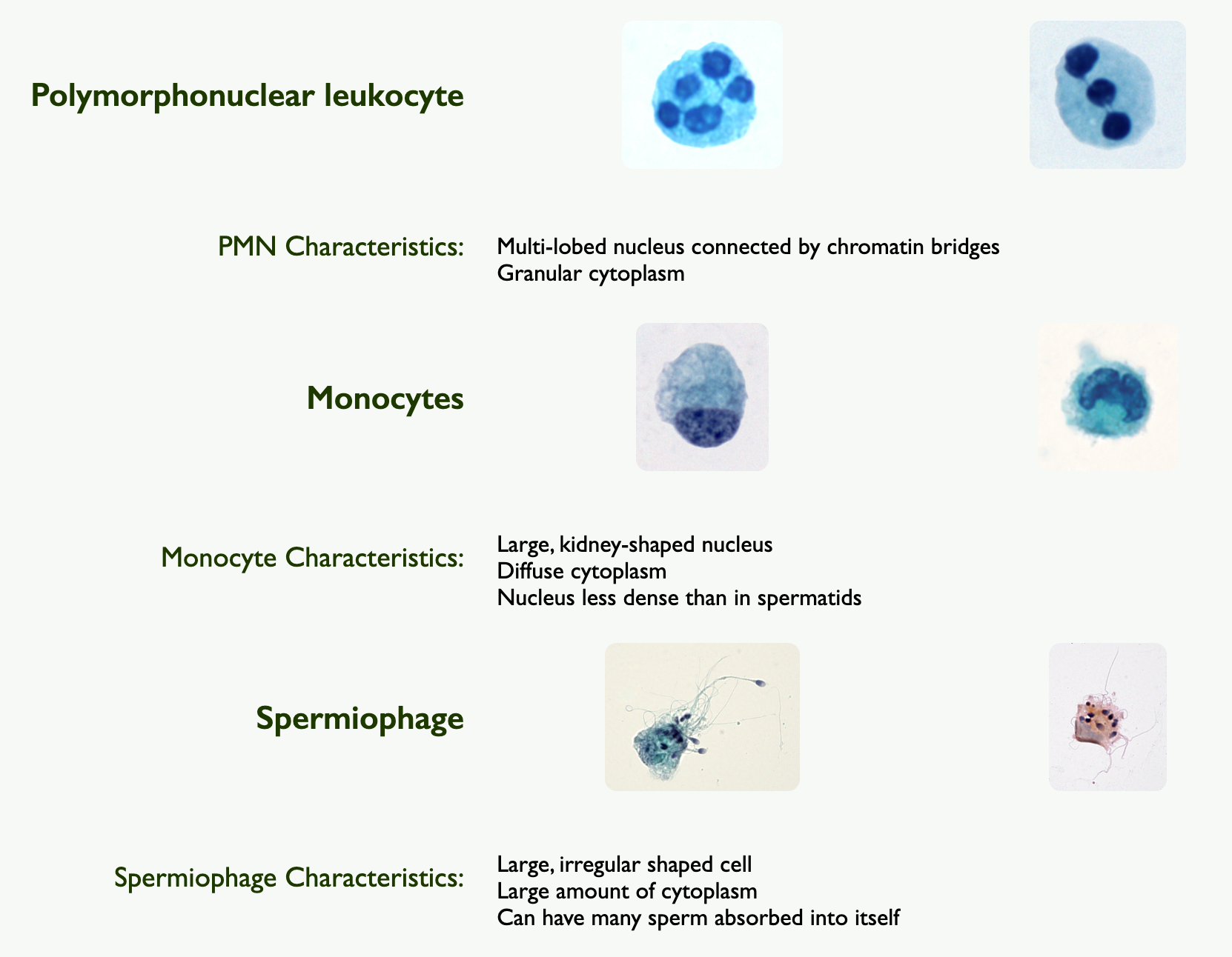 Article|Round Cells in Semen